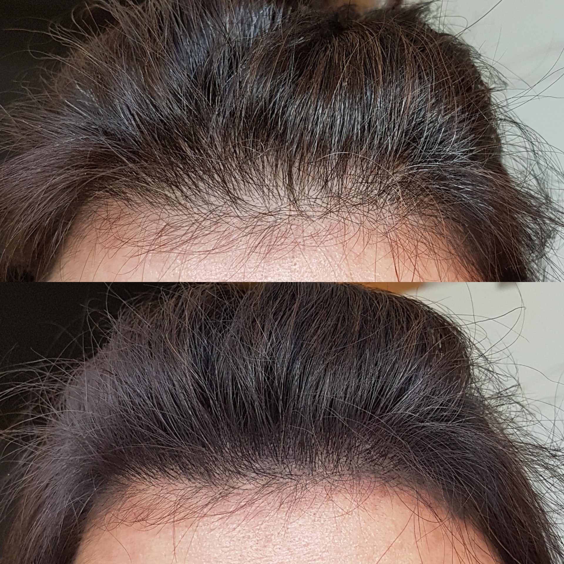 Sevich Hairline Powder Review | Raiyne On Beauty